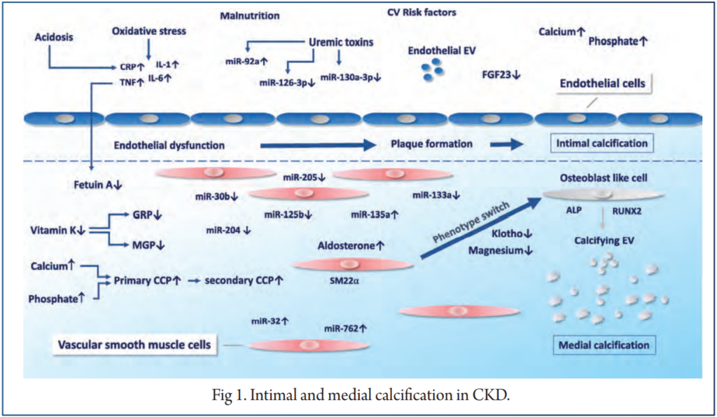 Vascular Pathologies in Chronic Kidney Disease: Pathophysiological ...
