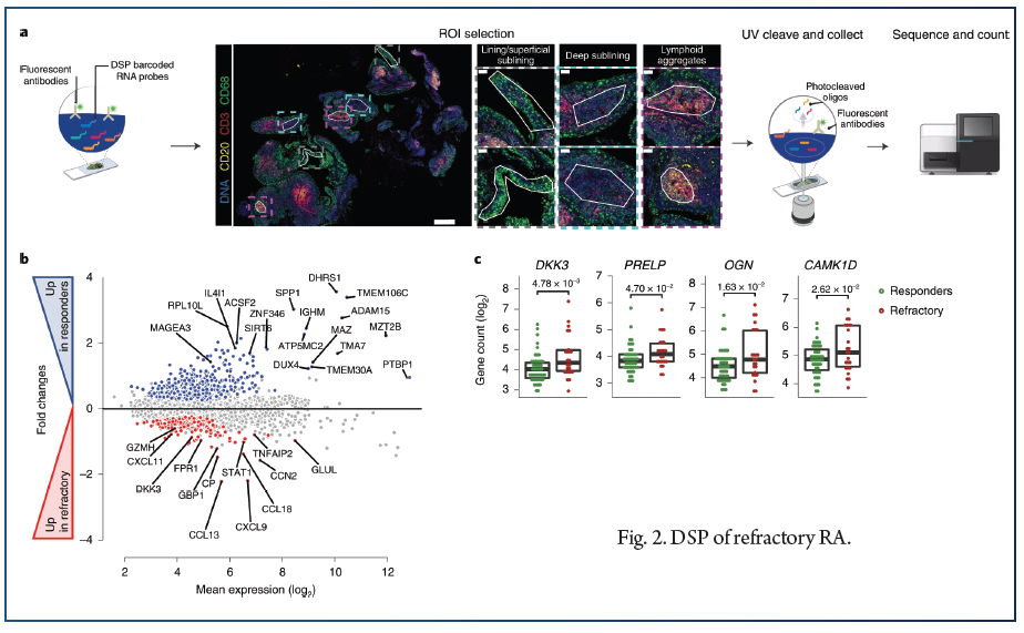 Rituximab versus tocilizumab in rheumatoid arthritis | Conquest Health