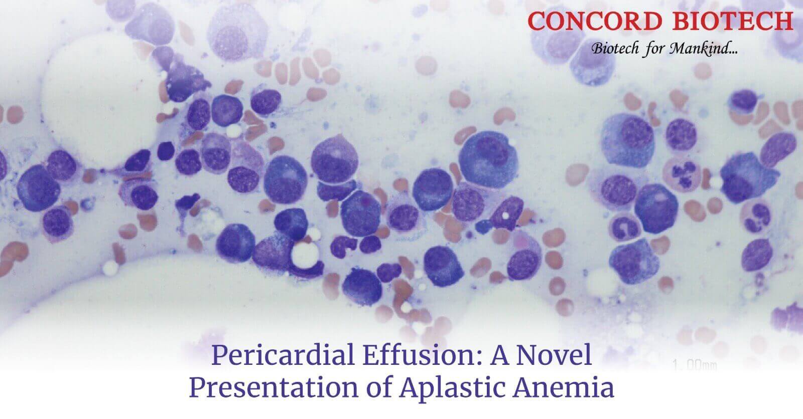 Pericardial Effusion in Aplastic Anemia | Conquest Health