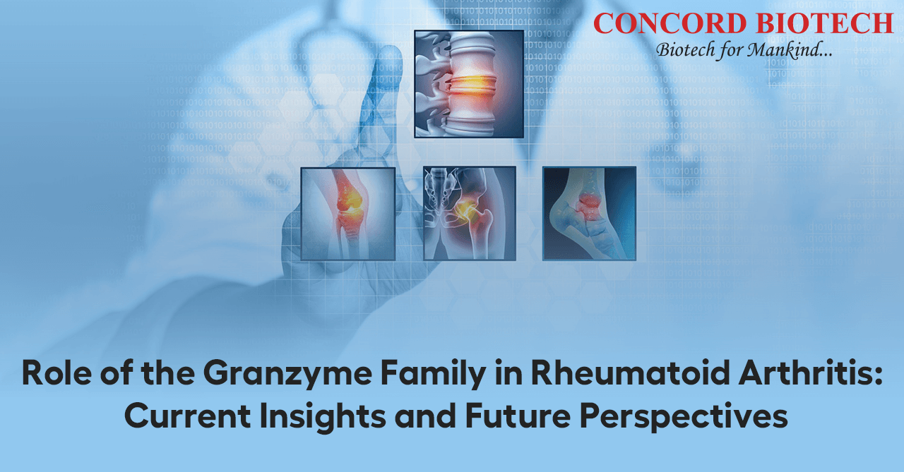 Role of the Granzyme Family in Rheumatoid Arthritis | Conquest Health
